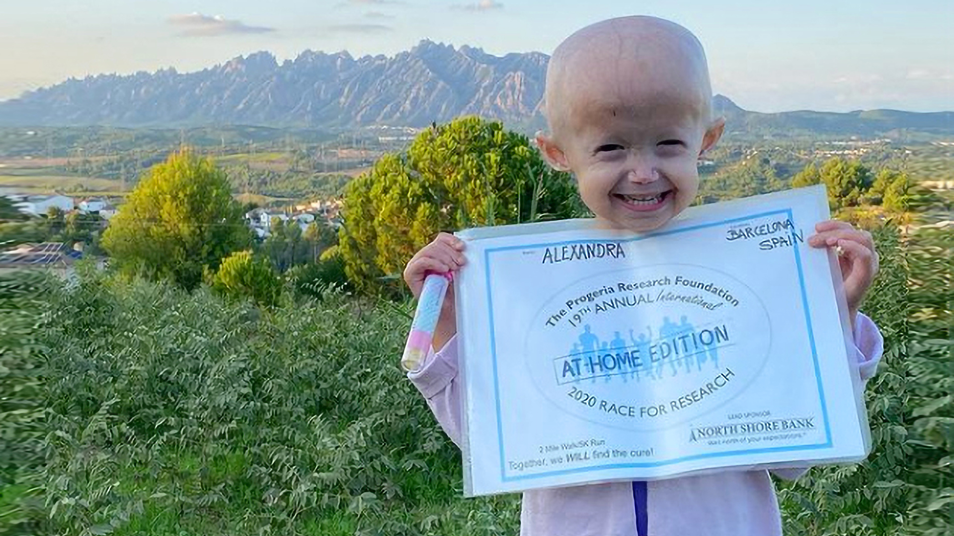 Four-Year-Old Girl Tries To Overcome Progeria By Enjoying Life - The ...